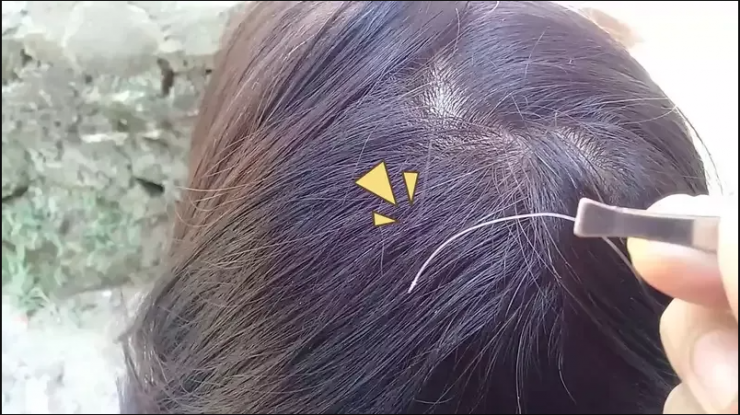 4 Cara Mengatasi Uban Agar Tidak Tumbuh Lagi di Usia Muda - Denotasi.com